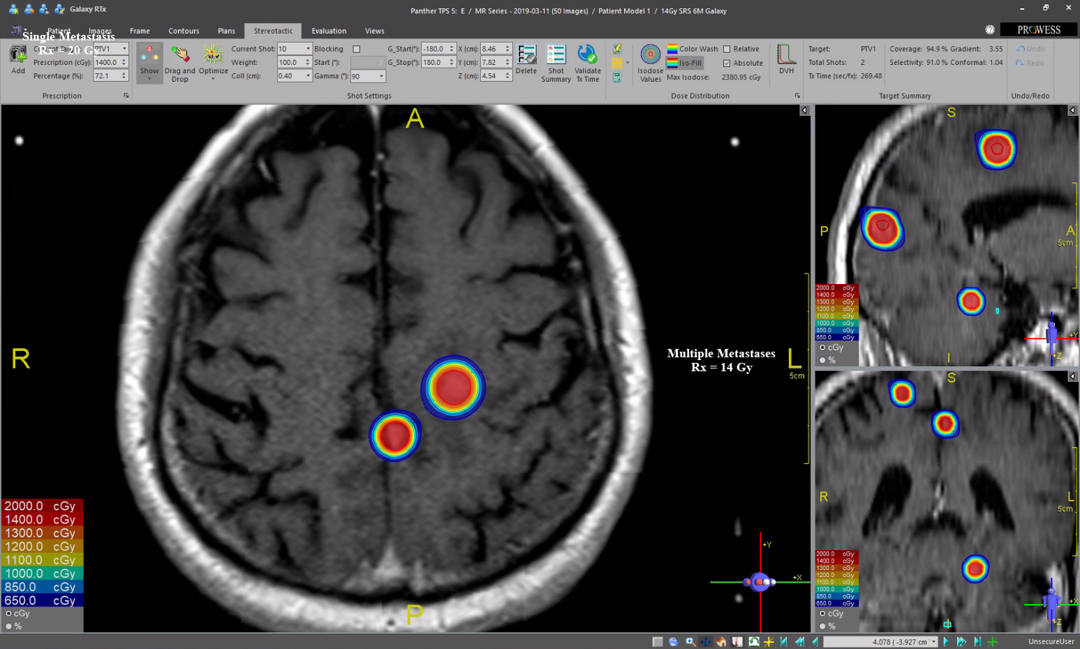 Prowess Panther™ TPS-SRS system